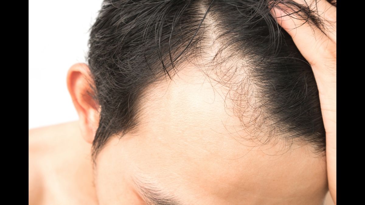 Put Hair Back Up There | OneChristianMan and Flesh Tamers Fitness